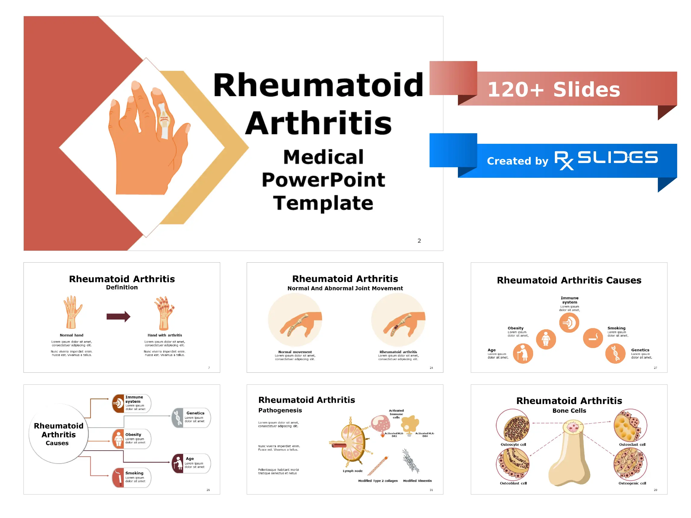Download Rheumatoid Arthritis Powerpoint Template Rxslides